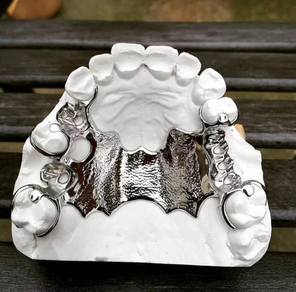 Quality Cobalt Chrome Removable Partial Denture Framework Laser Printing Ni Be Free for sale