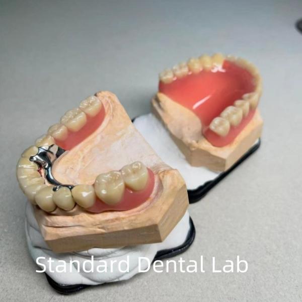 Υψηλή αισθητική CAD CAM Δόντι μερική προσάρτηση οδοντοστοιχίας Αντικατάσταση Τυποποιημένο οδοντιατρικό εργαστήριο