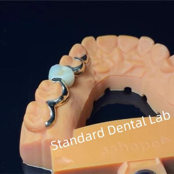 Quality Dental Teeth PFM Maryland Bridge High Esthetics FDA Certified for sale