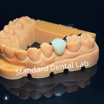 Quality Dental Teeth PFM Maryland Bridge High Esthetics FDA Certified for sale