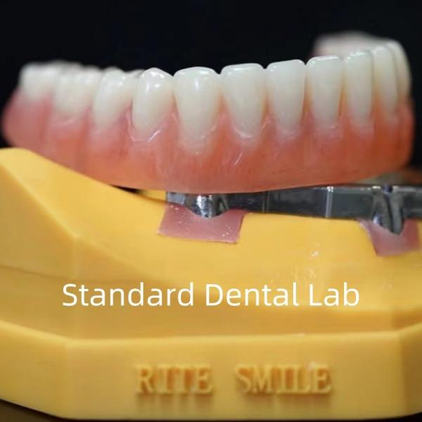 Quality Titanium Implant Supported Dentures Precise Ivoclar Denture Over Implants ISO FDA CE for sale