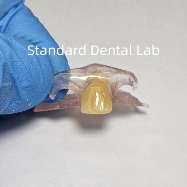 Quality Dental TCS Valplast Flexible Partial Dentures Staining Fading Odors Resistant for sale