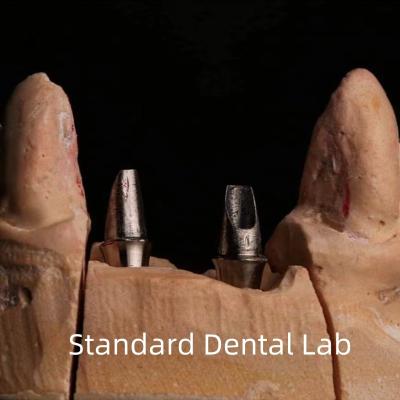 Cina Dental Porcellana Zirconia Impianto Corona Professionale Alta Estetica in vendita