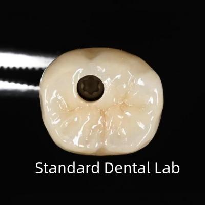 Cina Corone di impianto dentale a vite in vendita