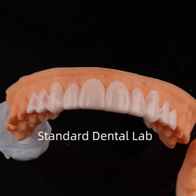 Quality High Esthetics Dental Snap On Smile Standard Dental Lab for sale