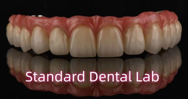 Quality High Quality dental implant crown/bridge Zirconia Crown and All On Four Six Implant Full Arch|China dental lab for sale