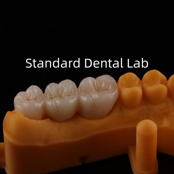 Quality Be Ni Free Metal Porcelain Crowns Precise Esthetic PFM Crown Dental for sale