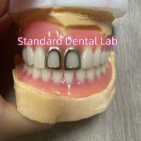 Quality ISO Full Acrylic Dentures With Yellow Gold Teeth Open Face for sale