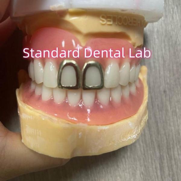 Quality ISO Full Acrylic Dentures With Yellow Gold Teeth Open Face for sale