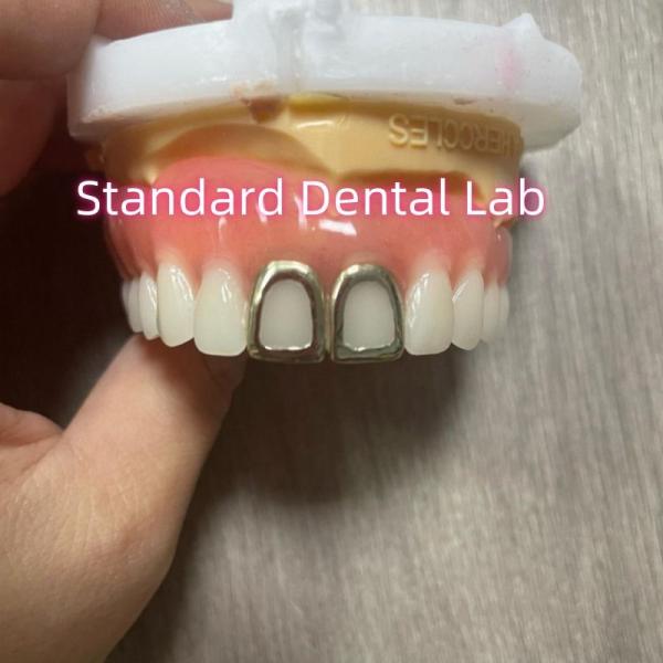 Quality ISO Full Acrylic Dentures With Yellow Gold Teeth Open Face for sale