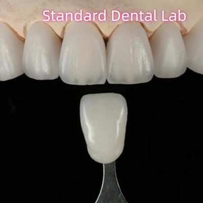 Quality High Aesthetic Natural Customized Aidite Zirconia Dental Bridge for sale