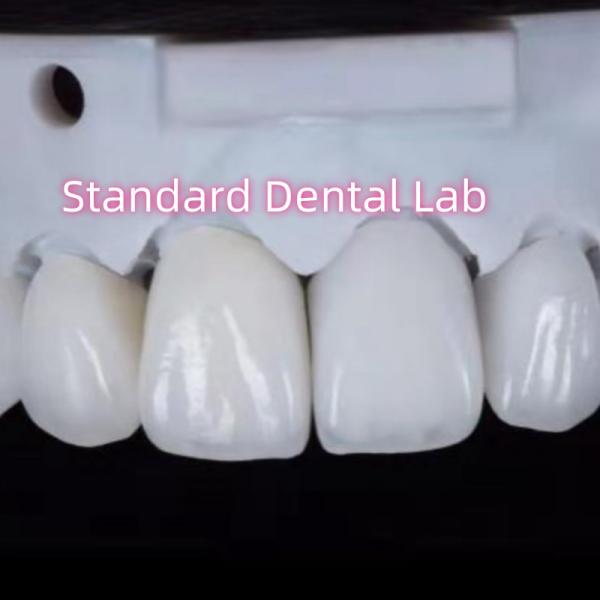 Quality Natural Looking Restorations Aidite Dental Zirconia Tooth Crown for sale