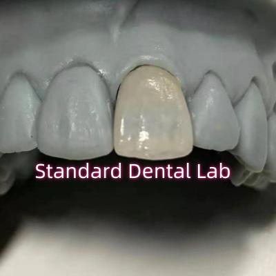 Quality Restorative Dentistry Emax Dental Zirconia Porcelain Crowns for sale