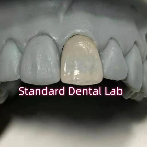 Quality Restorative Dentistry Emax Dental Zirconia Porcelain Crowns for sale