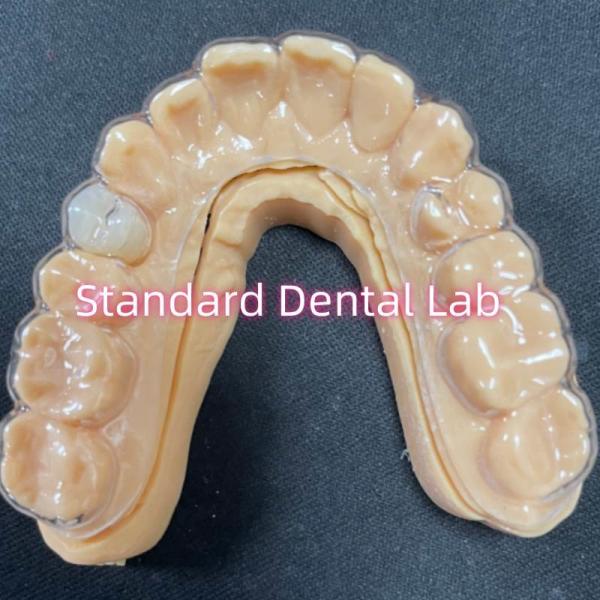 Quality Professional Orthodontic Retainer Clear Essix Retainers With Stable Acrylic Resin Teeth for sale