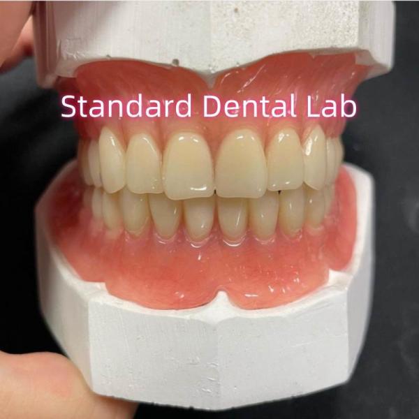 Quality Full Upper And Lower Stayplate Acrylic Partial Dentures Ivoclar Teeth Pink Gum for sale