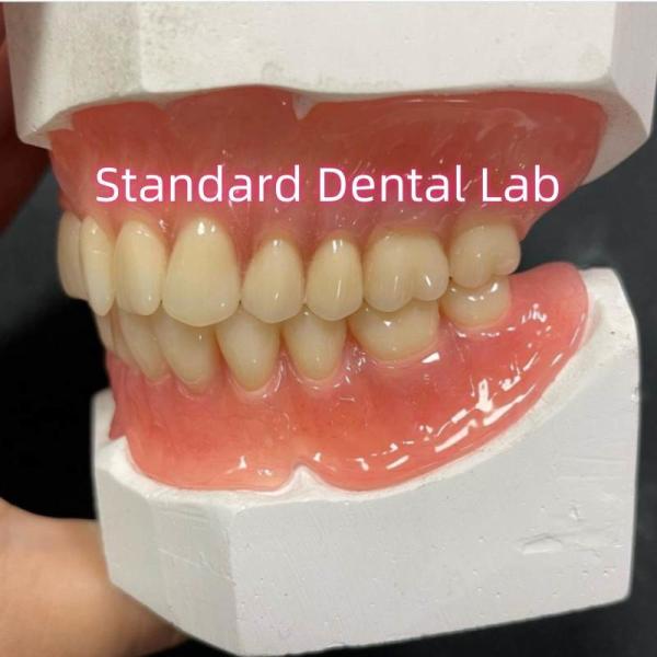 Quality Full Upper And Lower Stayplate Acrylic Partial Dentures Ivoclar Teeth Pink Gum for sale