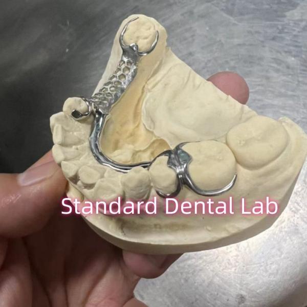 Quality Skelete Chrome Cast Partial Denture Metal Framework ISO for sale