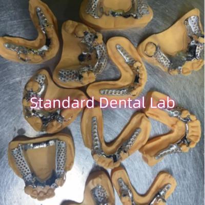 Quality Removable Cobalt Chrome Cast Metal Framework Partial Dentures for sale
