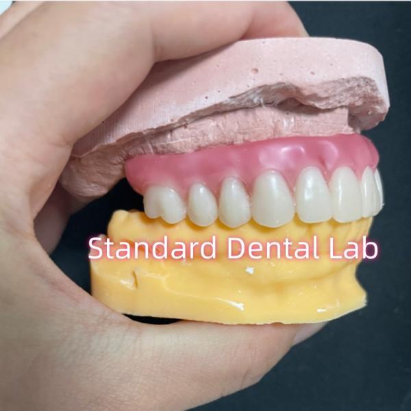 Quality Acrylic Partial Implant Over Denture Titianium Bar Full Denture Teeth Set Up for sale