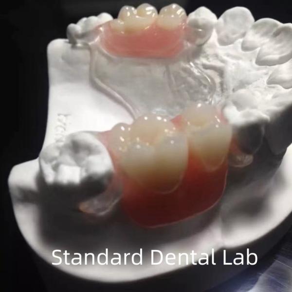 Quality Flexible Clear Metal Cast Framework Partial Dentures High Esthetics Perfect Fit for sale