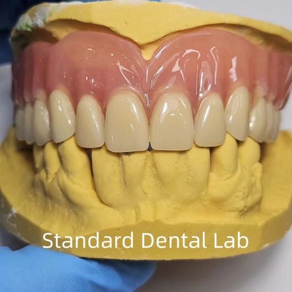 Quality Standard Ivoclar Complete Acrylic Denture Professional FDA Certified for sale