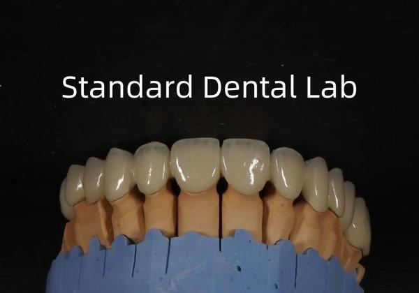 Quality China Dental Lab Metal Ceramic Crown PFM Crown High Esthetics for sale
