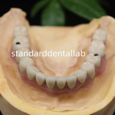 Quality Screw Retained Dental Implant Metal Ceramic Crowns Malo Bridge for sale