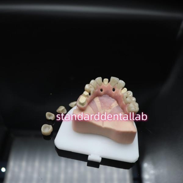 Quality Digital Dental Malo Implant Bridge Titanium Ivoclar Hybrid Zirconia Bridge for sale