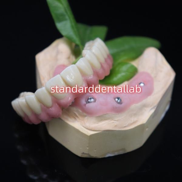 Quality Screwed All On 6 Full Zirconia Bridge Dental High Accuracy Over Ti Base for sale