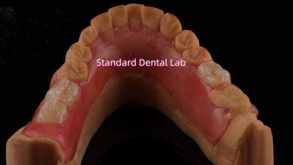 Quality High Esthetics Dental TCS Valplast Flexible Partial Dentures Dental Lab pink for sale