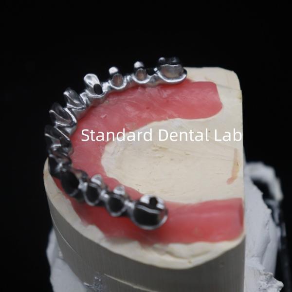 Quality Full Arch Malo Bridge Dental Restoration Zirconia Crowns With Gum Poecelian for sale