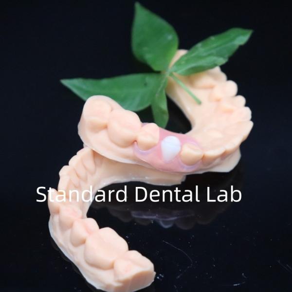 Quality Esthetic Valplast Flexible Dentures with Free Redo Policy in 3 Days China Dental for sale
