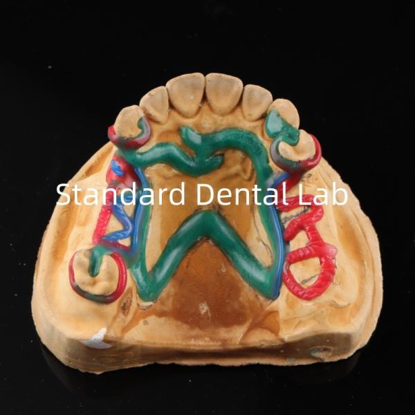 Quality Cobalt Chrome Framework Ni Be Free removable dental prosthesis China Dental Lab for sale
