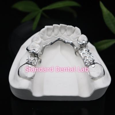 China Vitallium 2000 marco parcial ISO CE y FDA China laboratorio dental marco metálico dentadura parcial en venta