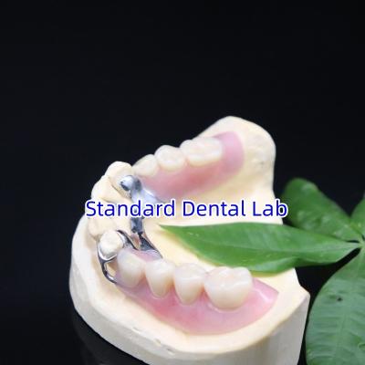 China Cuadro de dentadura parcial de acrílico metálico Alta estética laboratorio dental SDL en venta