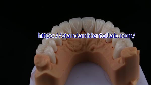Quality FDA High Esthetics Dental Zirconia Bridge With Layered Porcelain zirconia dental for sale