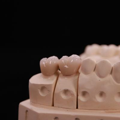 Cina Confortevole corona di zirconia con finitura estetica precisa Express 3-4 giorni Tempo di consegna in vendita