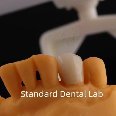 China Full Contour Dental Lab Crowns High Translucency Solid Zirconia Crown China Dental Lab for sale