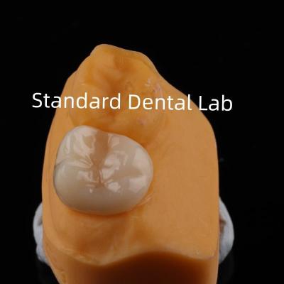 Cina Garanzia di 5 anni Corona di zirconia a contorno completo per denti molari Noritake porcellana realizzata da un laboratorio dentale di fiducia in vendita