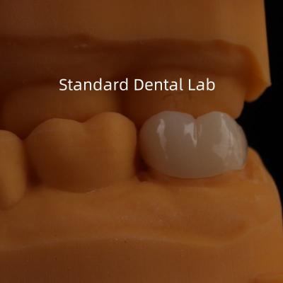 Cina Garanzia di 5 anni Corona di zirconia a contorno completo per denti molari Noritake porcellana realizzata da un laboratorio dentale di fiducia in vendita
