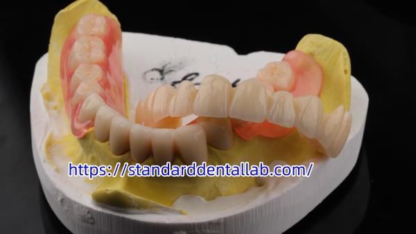 Quality High Esthetics Dental TCS Valplast Flexible Partial Dentures Dental Lab Valplast Clasp Pink Shade for sale
