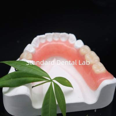 Cina Alta estetica Dentsply Lucitone 199 Protesi acrilica resina acrilica per protesi in vendita