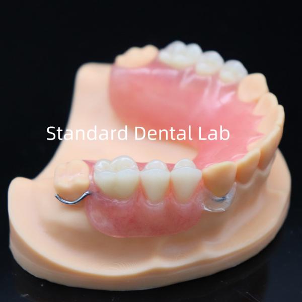 Quality High Esthetics Acrylic Partial Denture With Clear Clasp And Acrylic Teeth China for sale