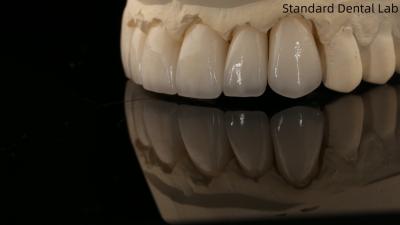 China Volledige contour Zirconia kroon en hoge esthetiek natuurlijke gebit brug 5 jaar garantie Te koop