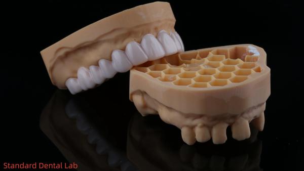 Quality High Esthetics Dental Snap On Smile Standard Dental Lab Removable Dental for sale