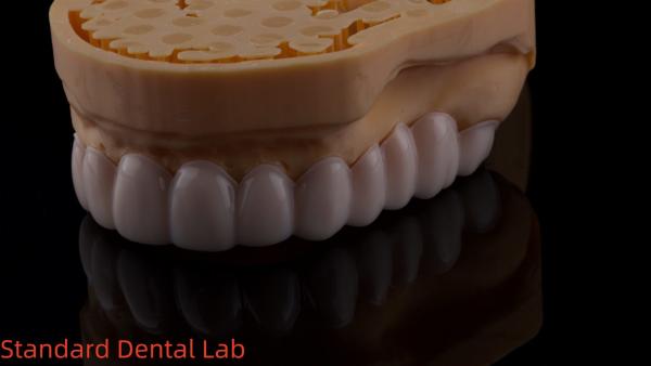 Quality High Esthetics Dental Snap On Smile Standard Dental Lab Removable Dental for sale