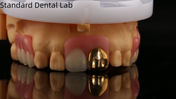 Quality Full Acrylic Dentures With Yellow Gold Teeth/Dental Temporary Acrylic Denture for sale