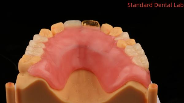 Quality Full Acrylic Dentures With Yellow Gold Teeth/Dental Temporary Acrylic Denture for sale