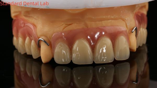 Quality Heat Cured Ivoclar Partial Acrylic Denture Dental Lab High Accuracy with 3D for sale